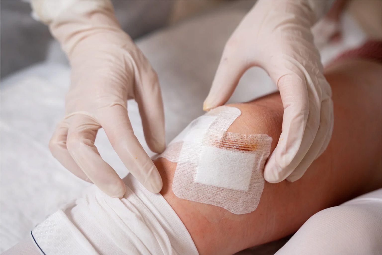 Innovation in Healing: The Impact of New Wound Closure Devices ...